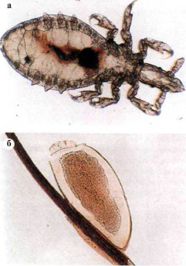 Ряд Воші (Anoplura) - Клас Комахи (Insecta) - Медична арахноентомологія ...